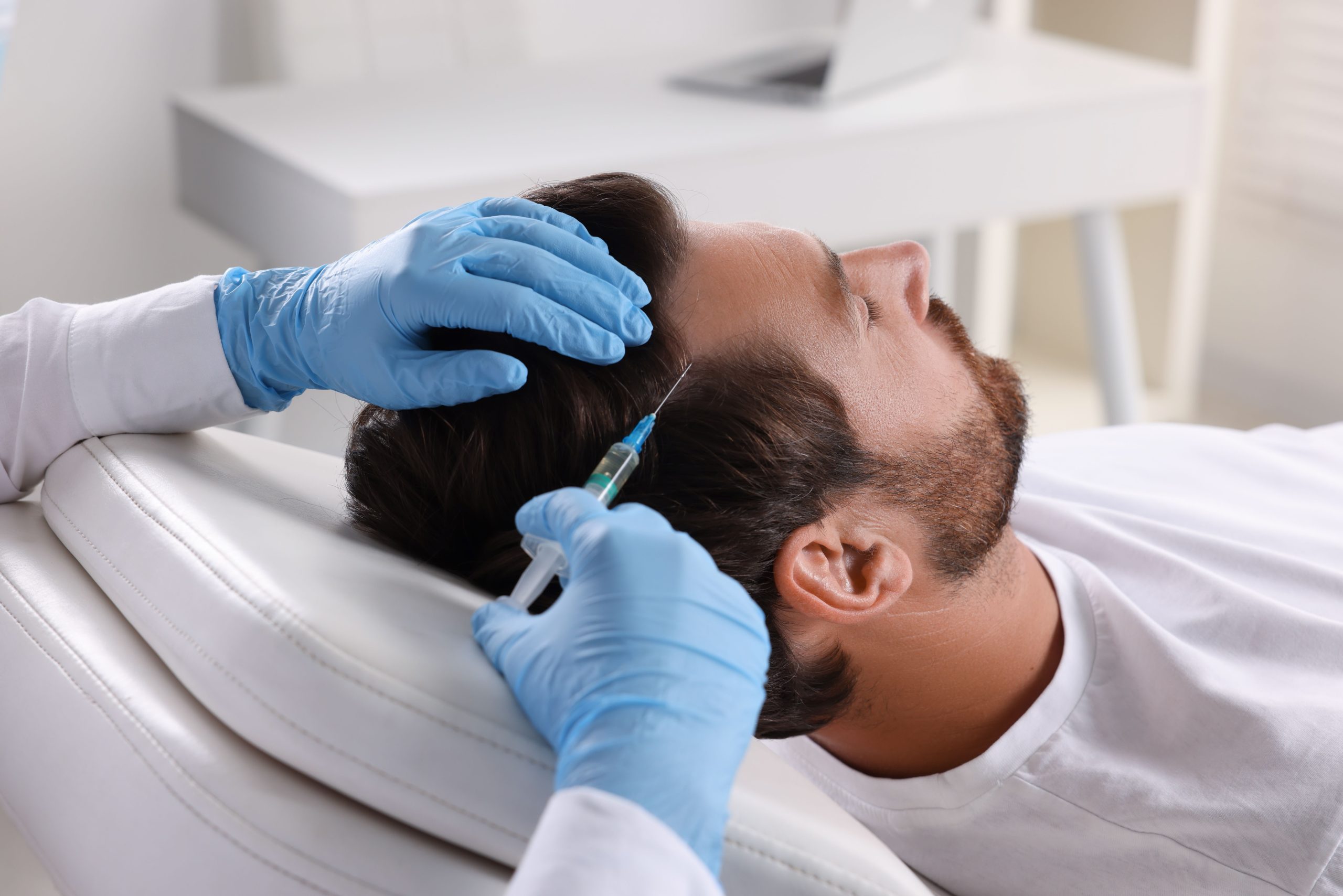Steroid Injections For Hair Loss: What It Is And How It Works